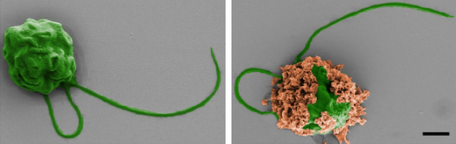 Microbot drug delivery, why you won’t see interferon, Medicare ...